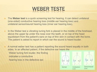 Methods of detection hearing | PPT