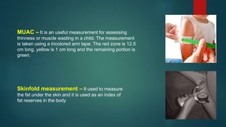Methods of Determining Nutritional Status in India | PPTX