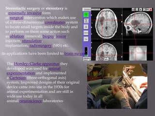 Methods of examining functions of CNS | PPTX | Brain and Nervous System ...