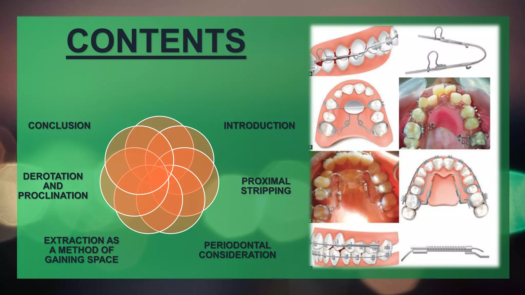 METHODS OF GAINIG SPACES DIVYA SINGH.pptx