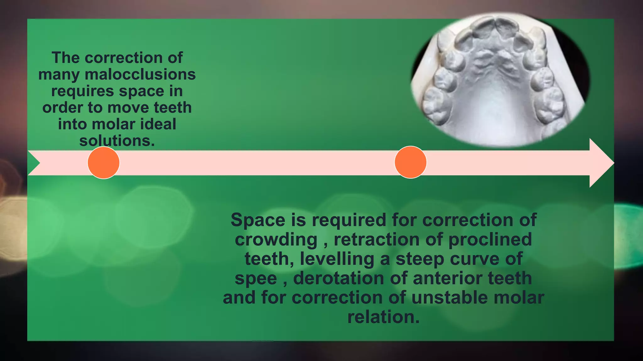 METHODS OF GAINIG SPACES DIVYA SINGH.pptx