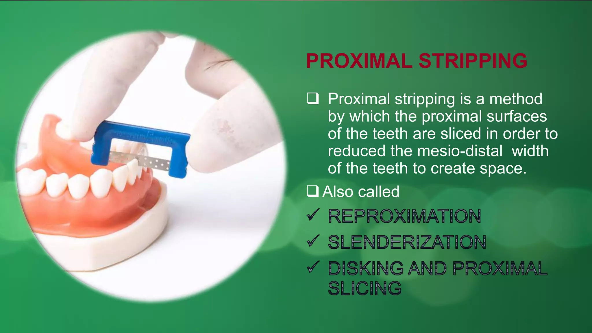 METHODS OF GAINIG SPACES DIVYA SINGH.pptx