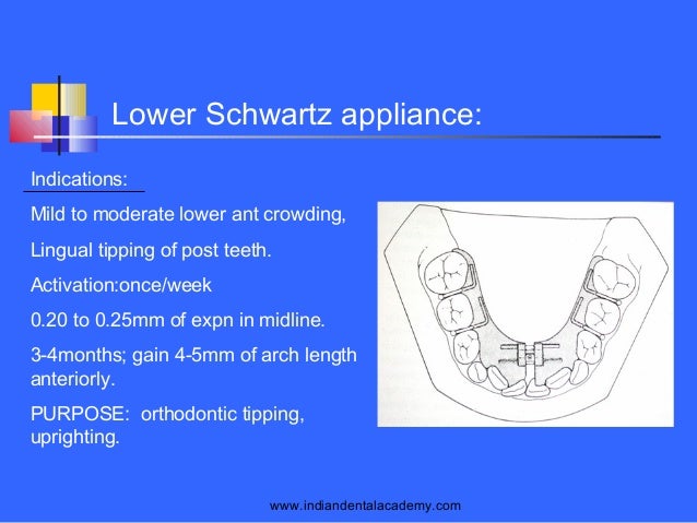 Methods of gaining space. /certified fixed orthodontic courses by Ind…