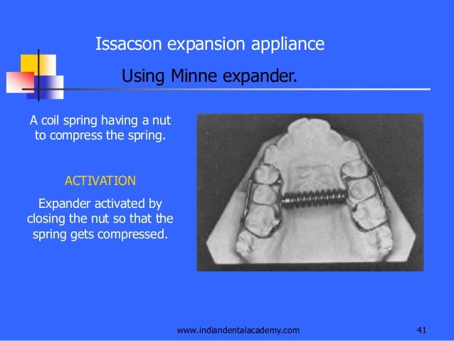 Methods of gaining space. /certified fixed orthodontic courses by In…