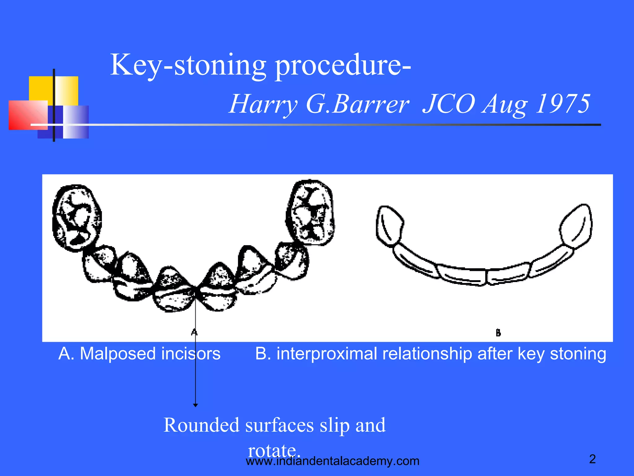 Methods of gaining space 1. /certified fixed orthodontic courses by ...