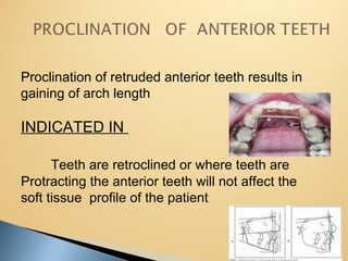 Methods of gaining space final | PPT