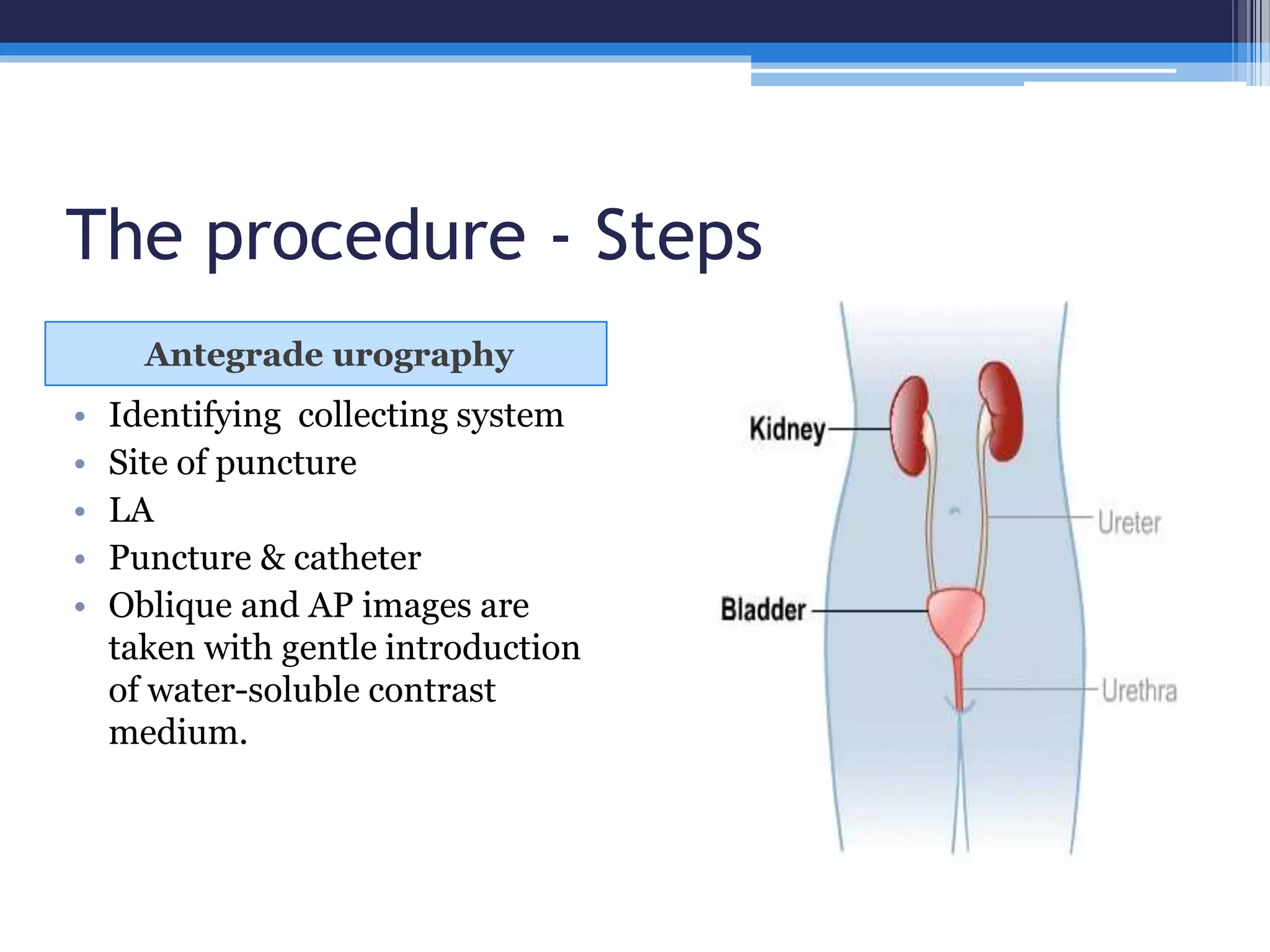 Methods of imaging of the urinary tract using contrast | PPTX