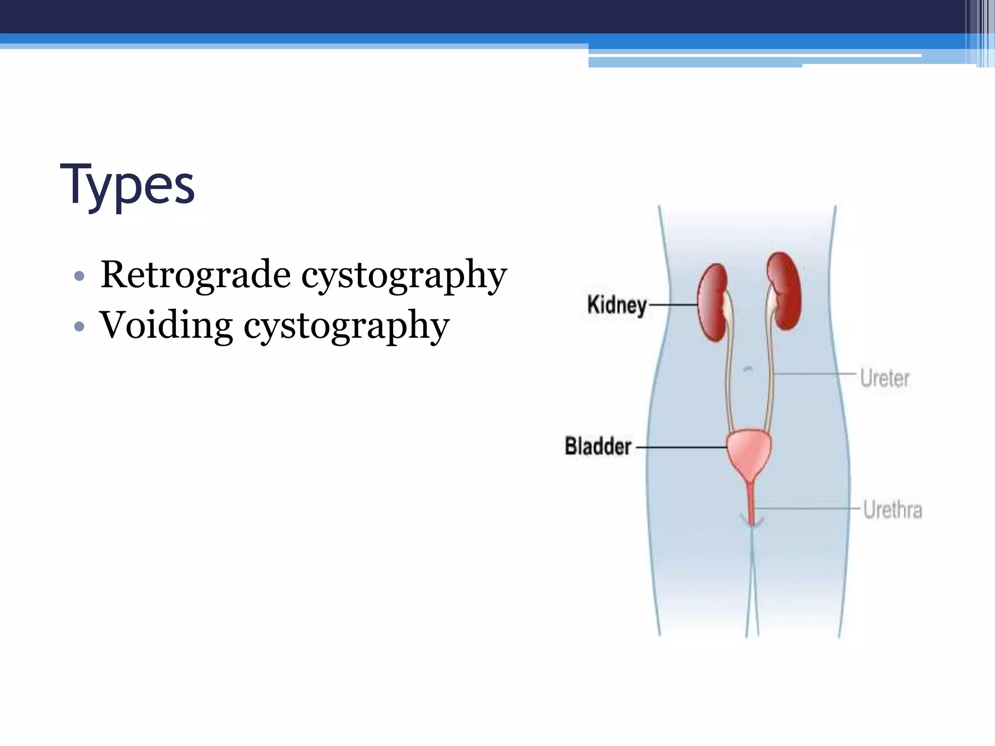 Methods of imaging of the urinary tract using contrast | PPTX