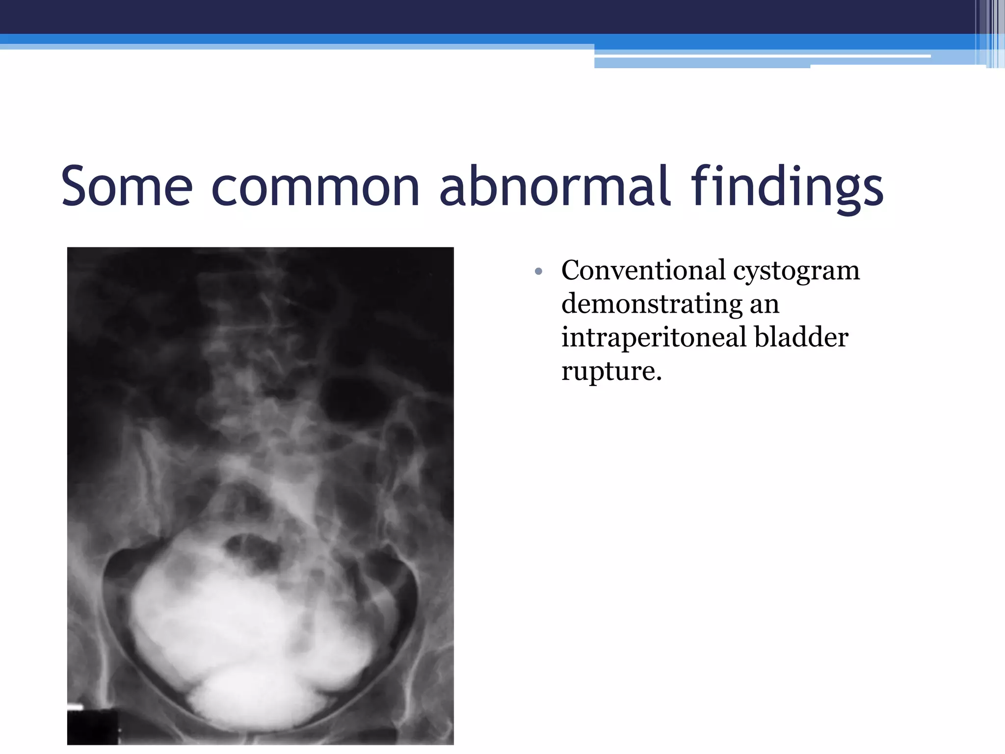 Methods of imaging of the urinary tract using contrast | PPTX