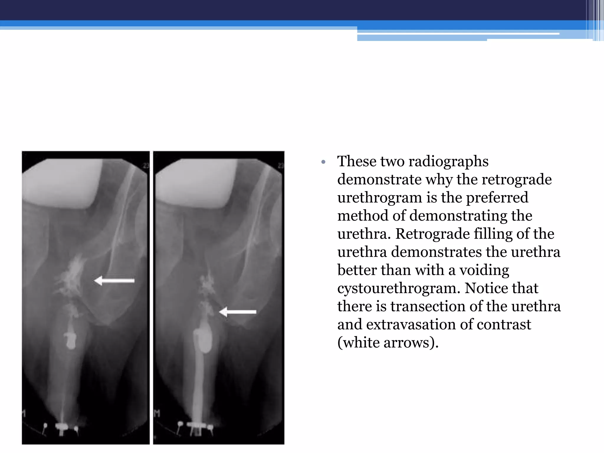 Methods of imaging of the urinary tract using contrast | PPTX