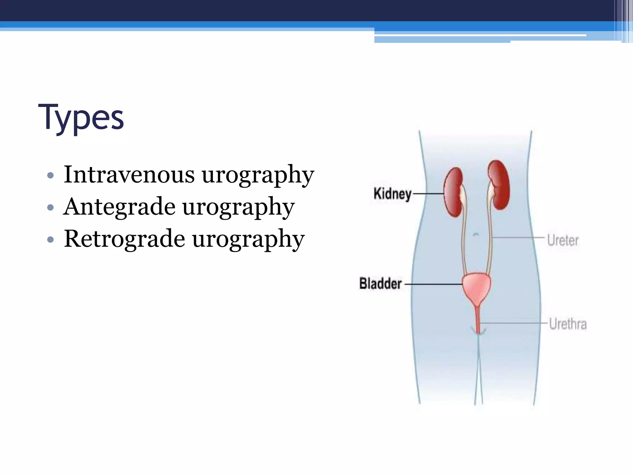 Methods of imaging of the urinary tract using contrast | PPTX