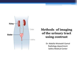 Methods of imaging of the urinary tract using contrast | PPTX