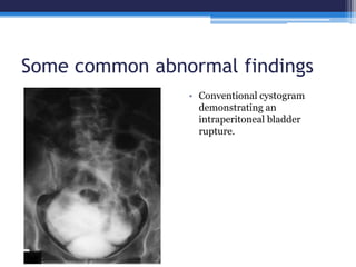 Methods of imaging of the urinary tract using contrast | PPTX