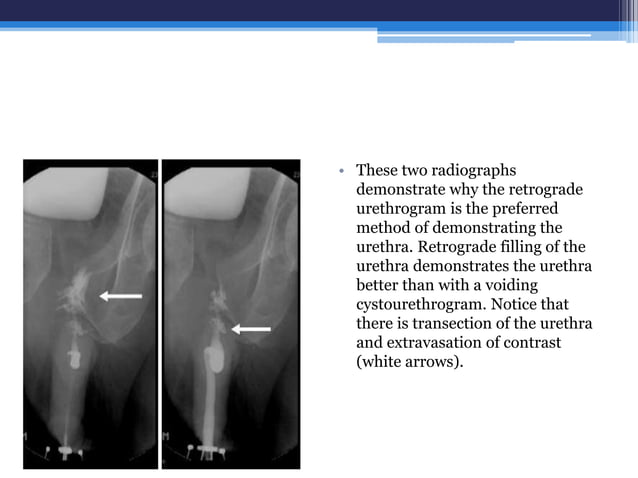 Methods of imaging of the urinary tract using contrast | PPTX