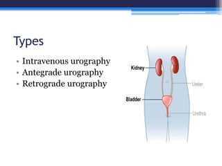 Methods of imaging of the urinary tract using contrast | PPTX