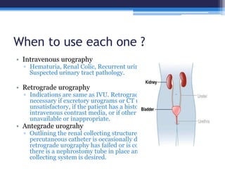 Methods of imaging of the urinary tract using contrast | PPTX