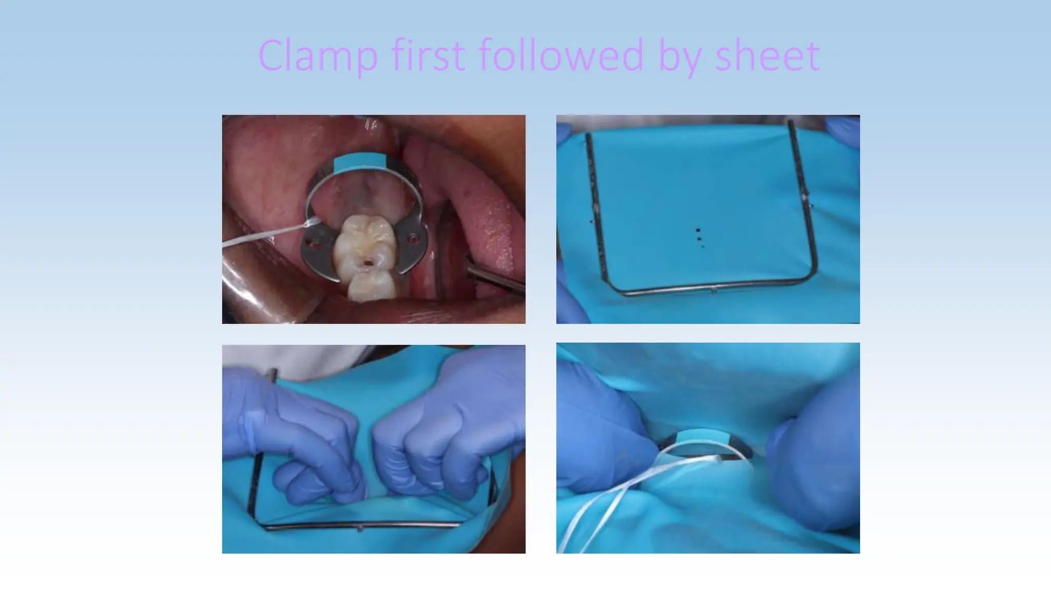 methods of isolation and rubber dam.pptx