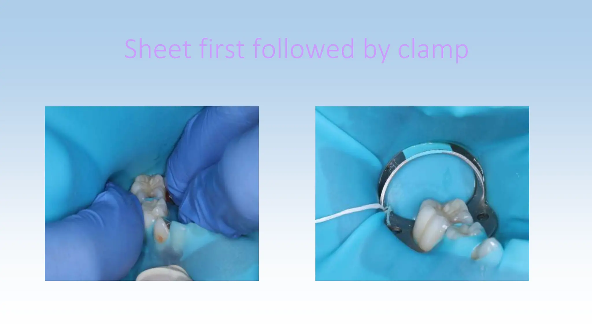 methods of isolation and rubber dam.pptx