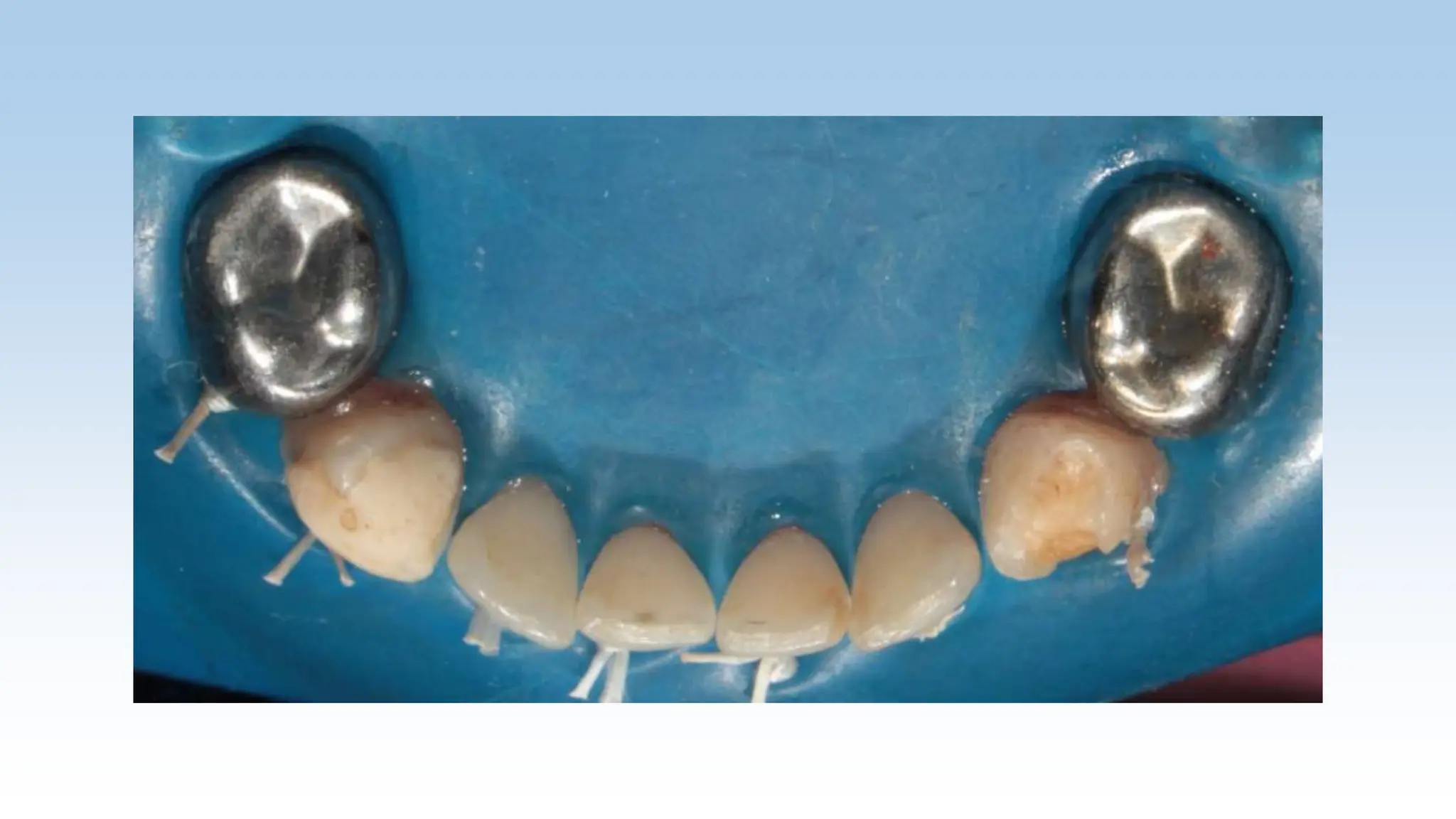methods of isolation and rubber dam.pptx