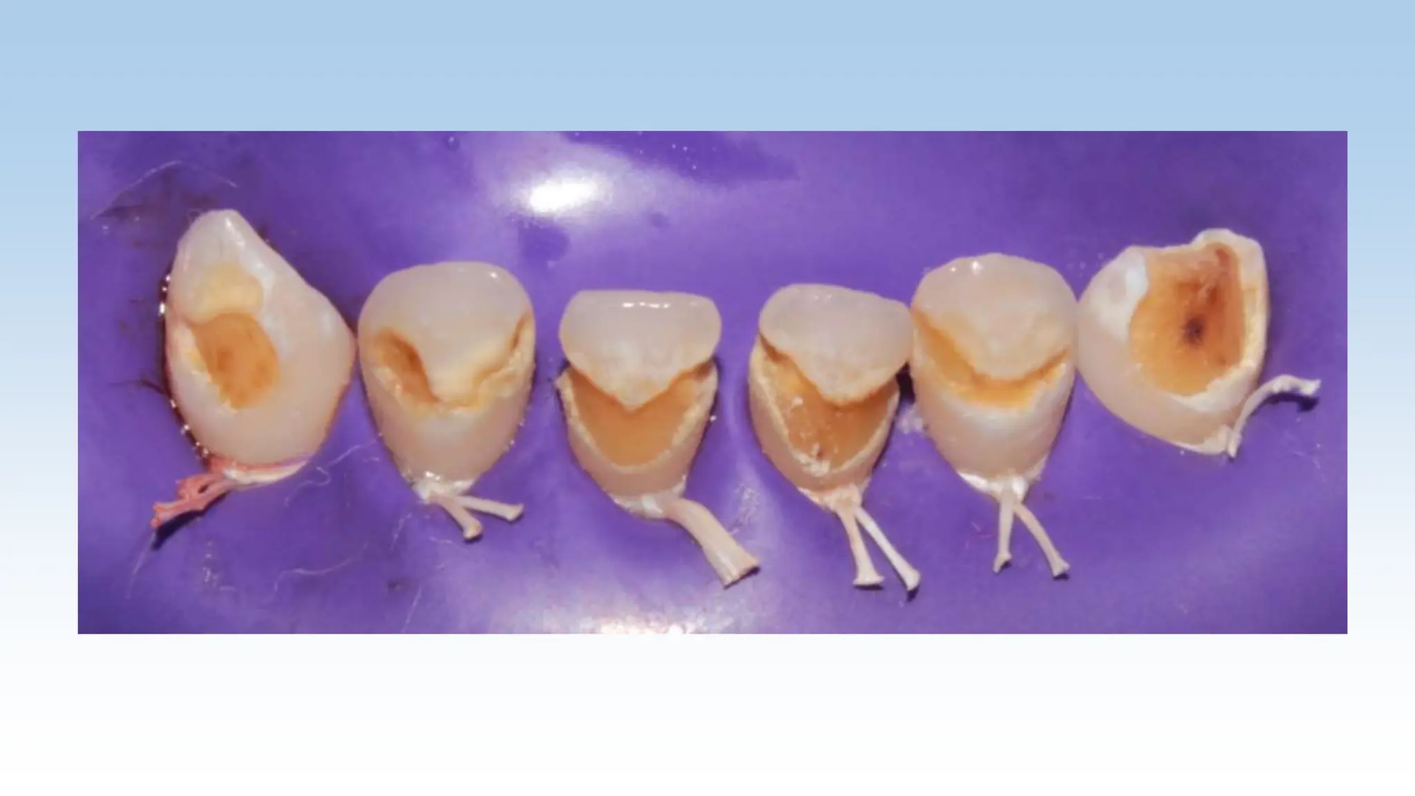 methods of isolation and rubber dam.pptx