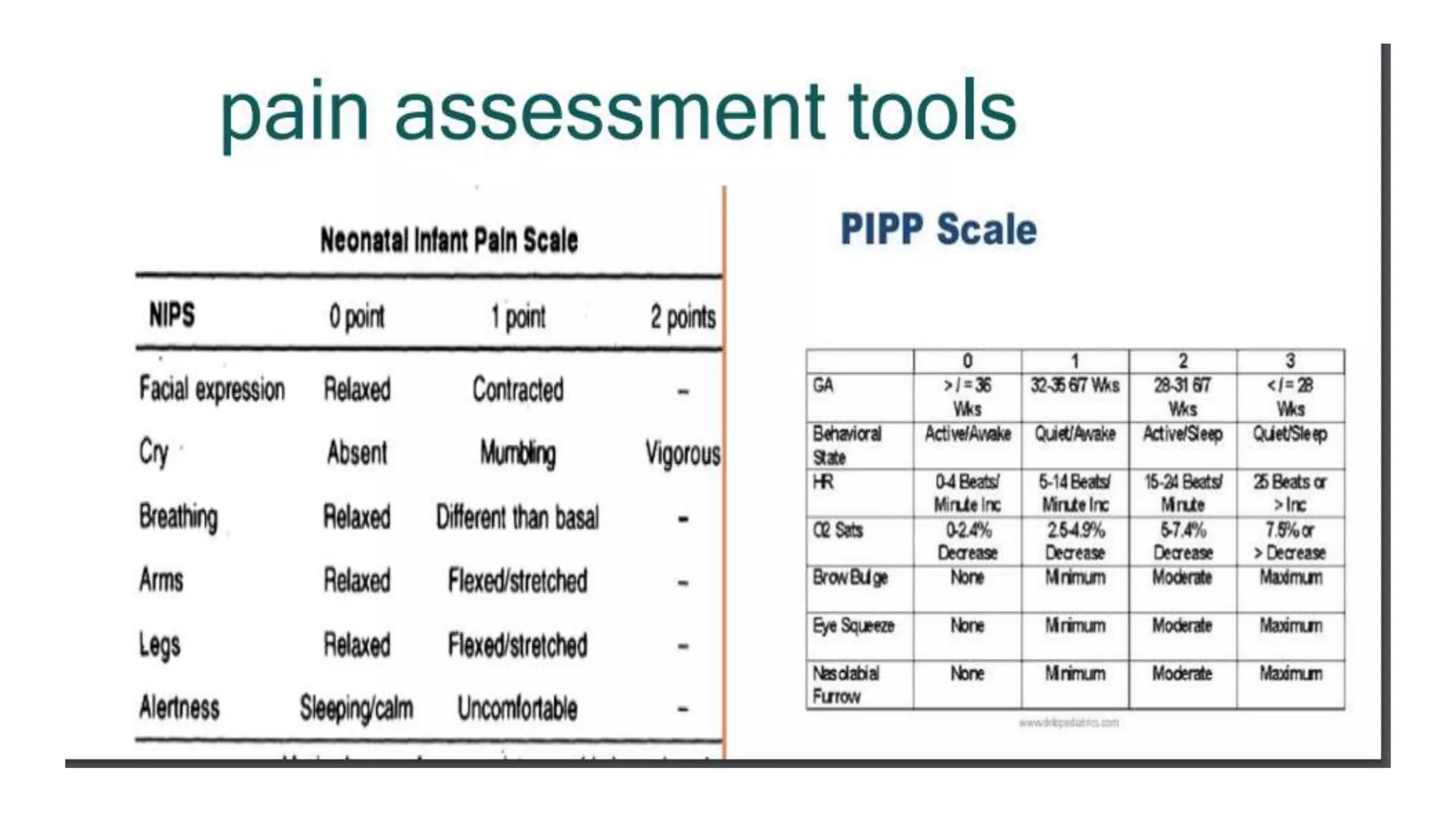 Methods of Pain Assessment in Children.pptx