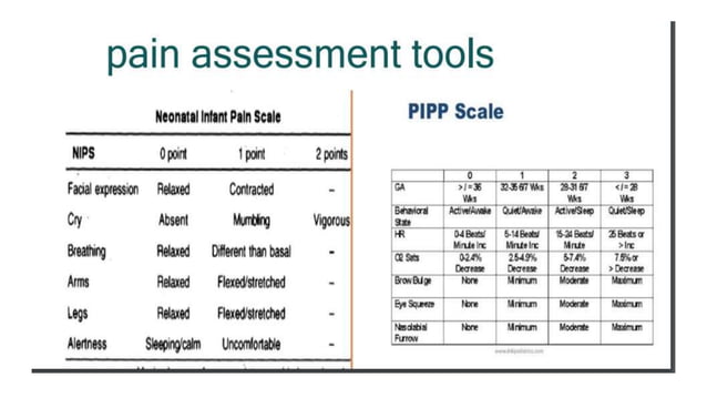 Methods of Pain Assessment in Children.pptx