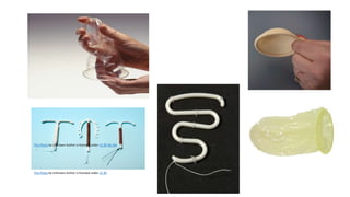 METHODS OF POPULATION CONTROL.pptx