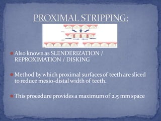 method of space gaining | PPT