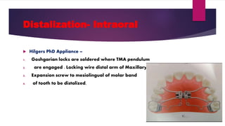 Methods of space gaining ortho | PPTX