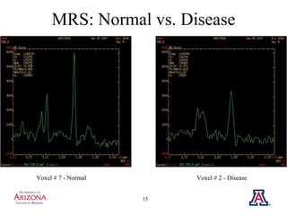 Methods To Differentiate Radiation Induced Necrosis And Recurrent ...