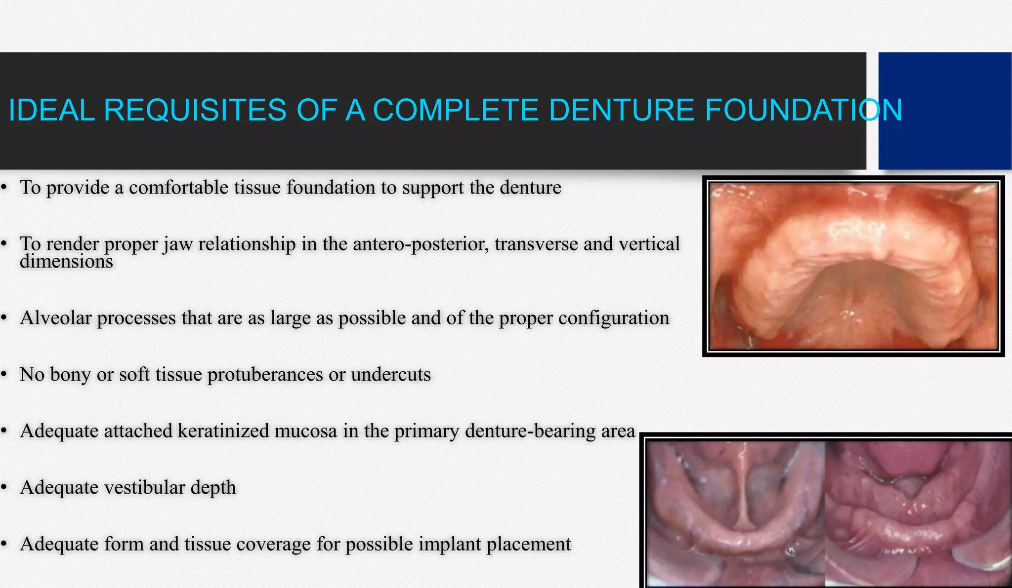 Methods to improve com[lete denture foundation 2 | PPTX