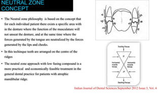 Methods to improve com[lete denture foundation 2 | PPTX