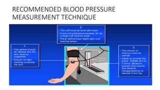 Methods to screen blood pressure | PPTX