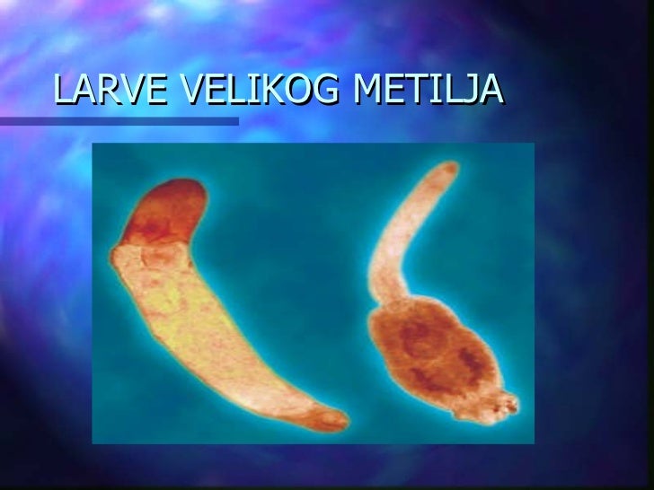 Metilji i pantljicar etanja