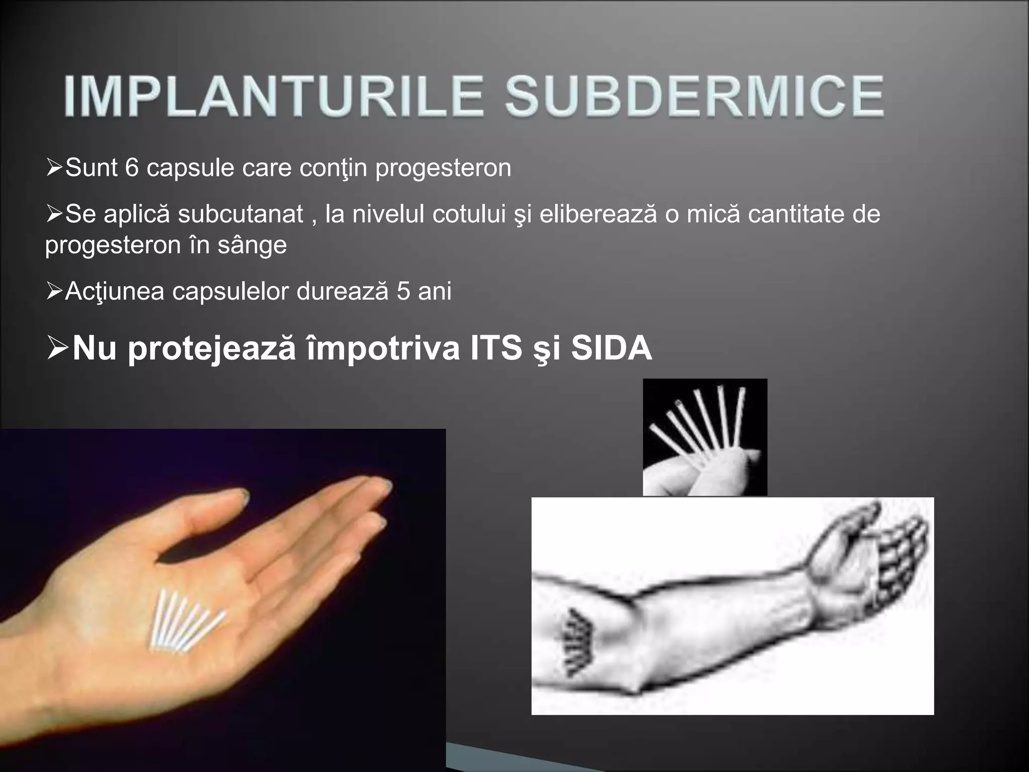 Metode contraceptive | PPT