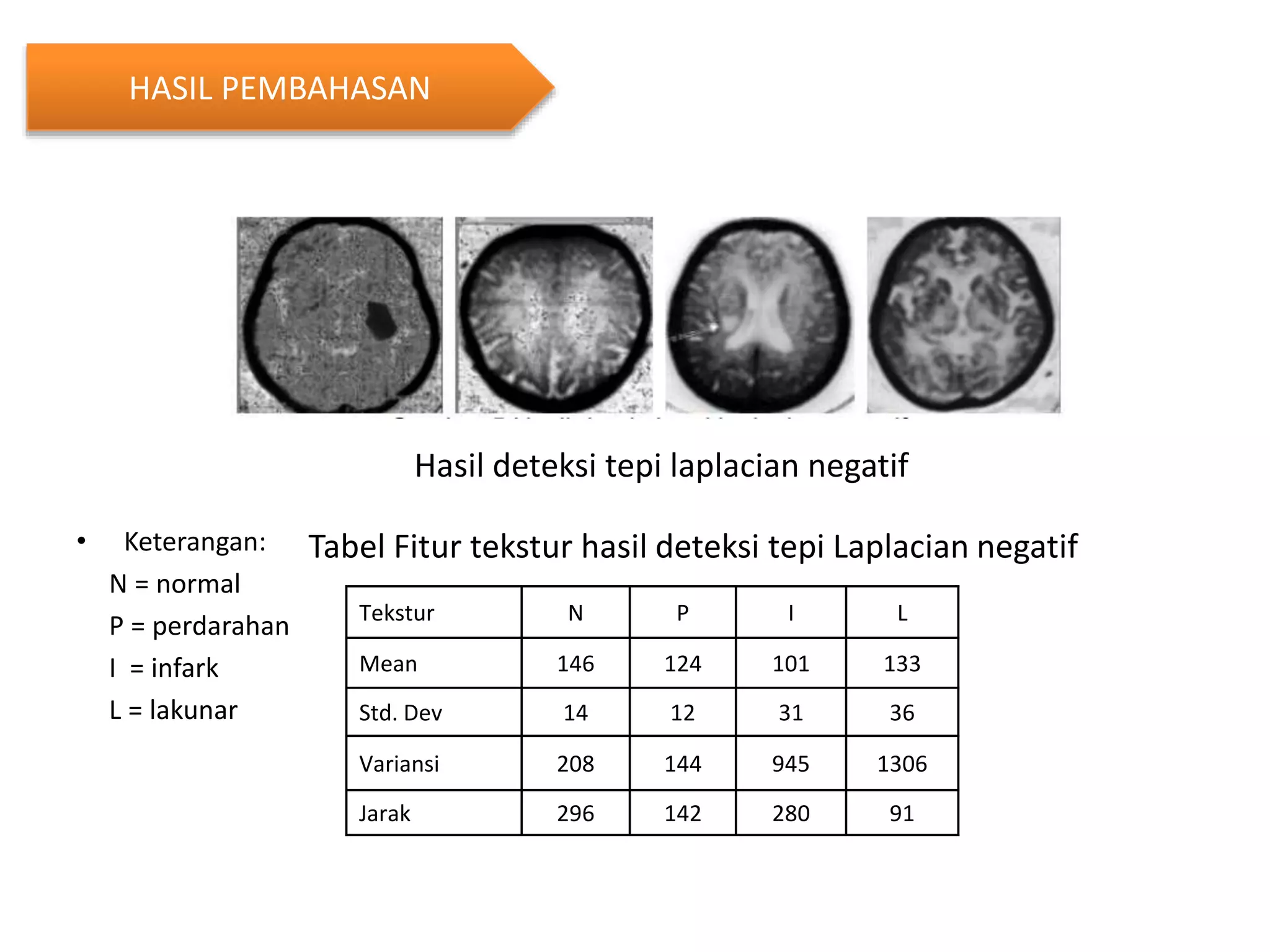 METODE SEGMENTASI UNTUK ANALISIS CITRA DIGITAL HEAD CT-SCAN | PPTX