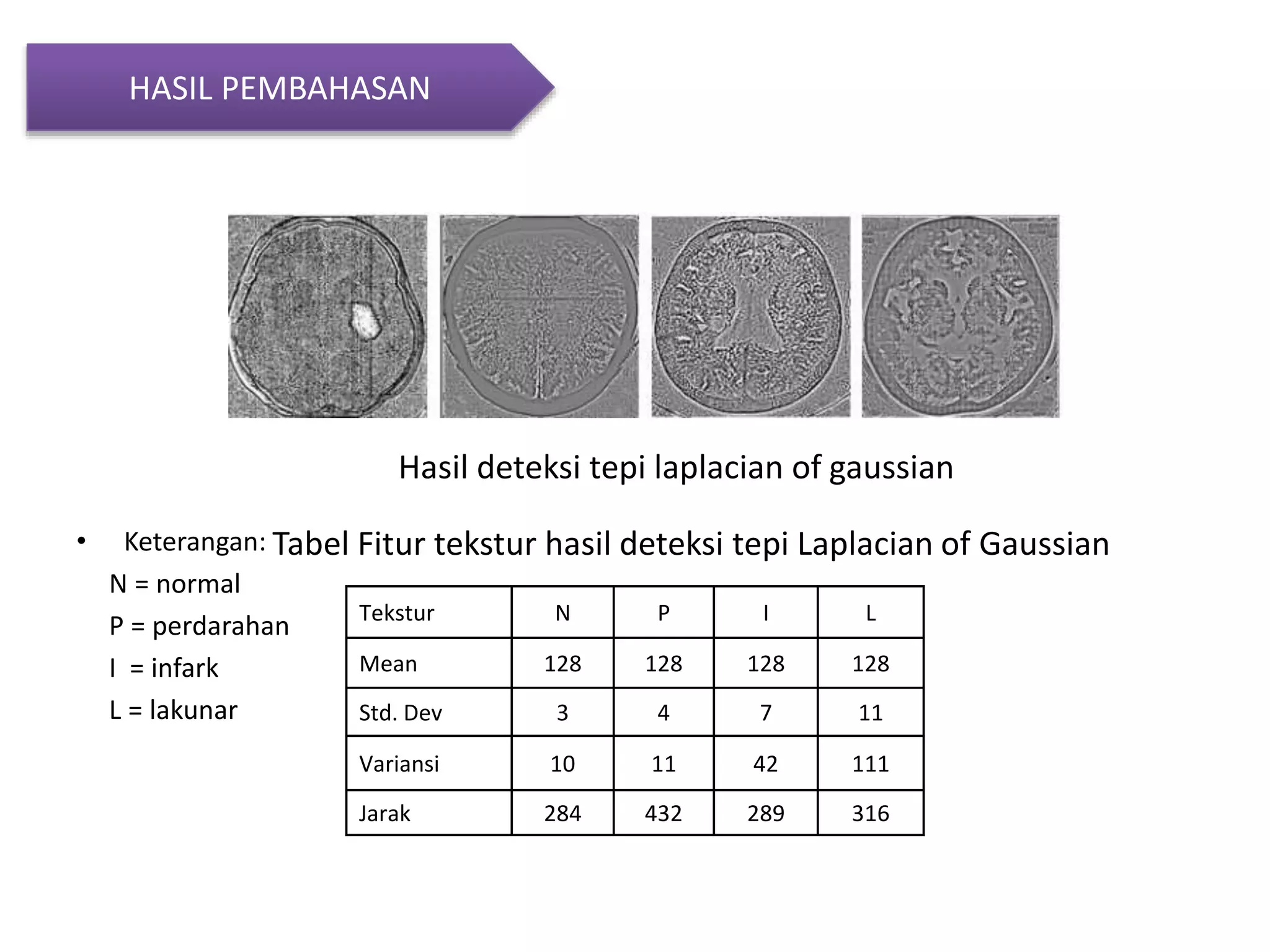 METODE SEGMENTASI UNTUK ANALISIS CITRA DIGITAL HEAD CT-SCAN | PPTX