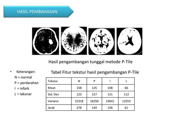 METODE SEGMENTASI UNTUK ANALISIS CITRA DIGITAL HEAD CT-SCAN | PPTX