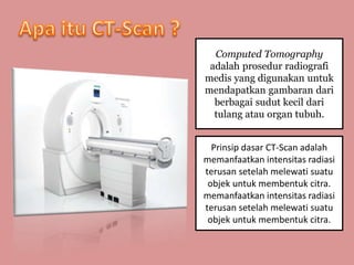 METODE SEGMENTASI UNTUK ANALISIS CITRA DIGITAL HEAD CT-SCAN | PPTX