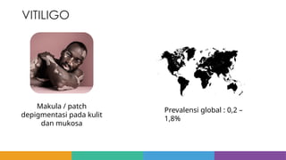 Berbagai Metode Untuk Asesmen Keparahan Skoring Vitiligo.pptx
