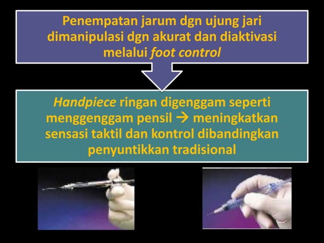 Metode the wand | PPT