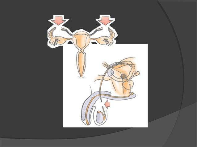 Metodo anticonceptivo otb