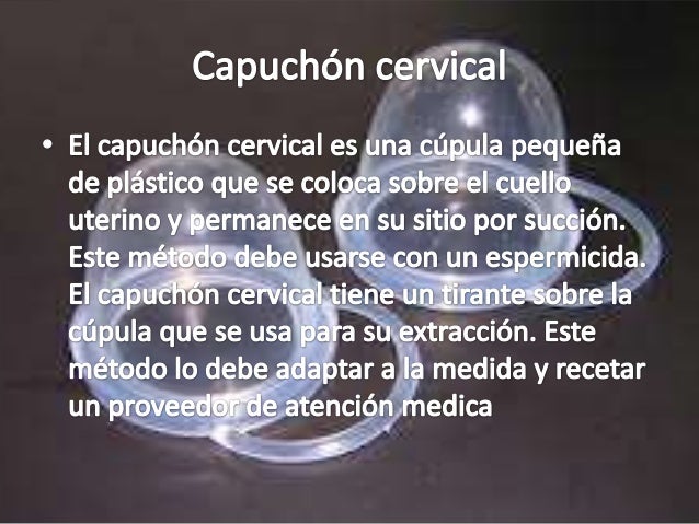 Metodos anticonceptivos