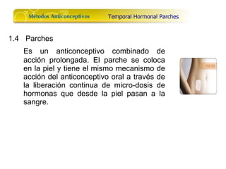 Métodos Anticonceptivos, pastillas, píldoras anticoncetivas, condón ...