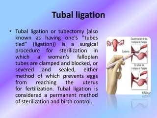 Metodos anticonceptivos por michell y jhon | PPT