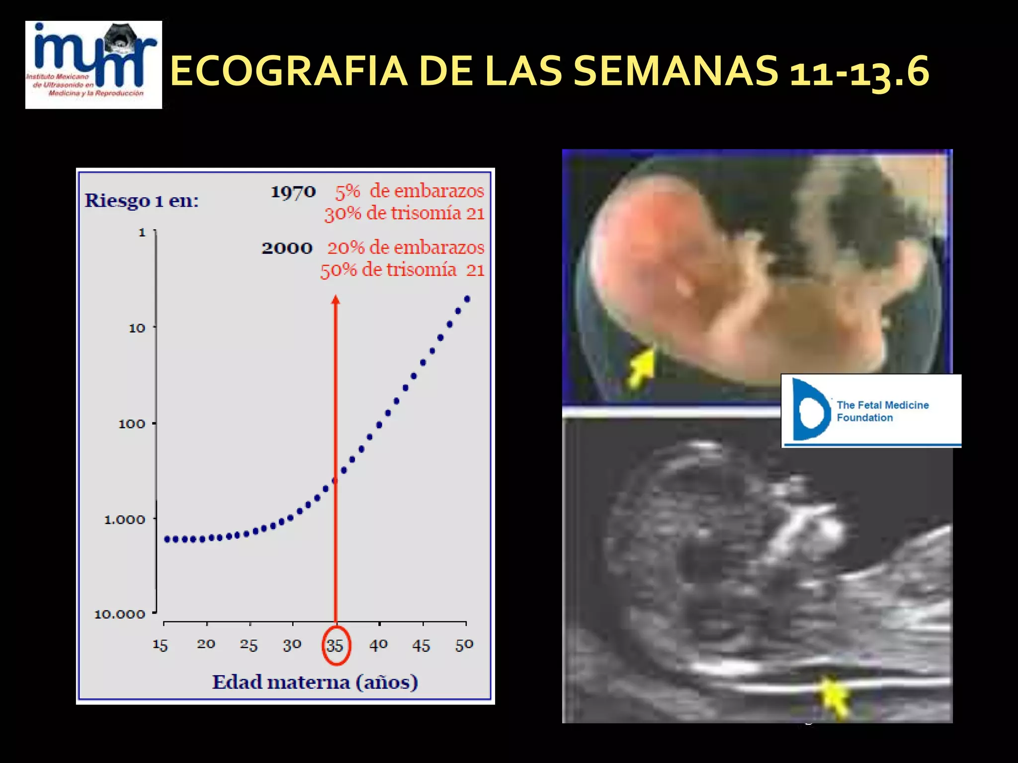 Metodos de cribado prenatal imumr dr. romel | PPT