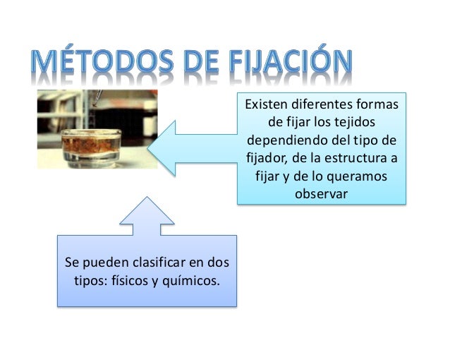 Metodos de fijacion Metodos de fijacion