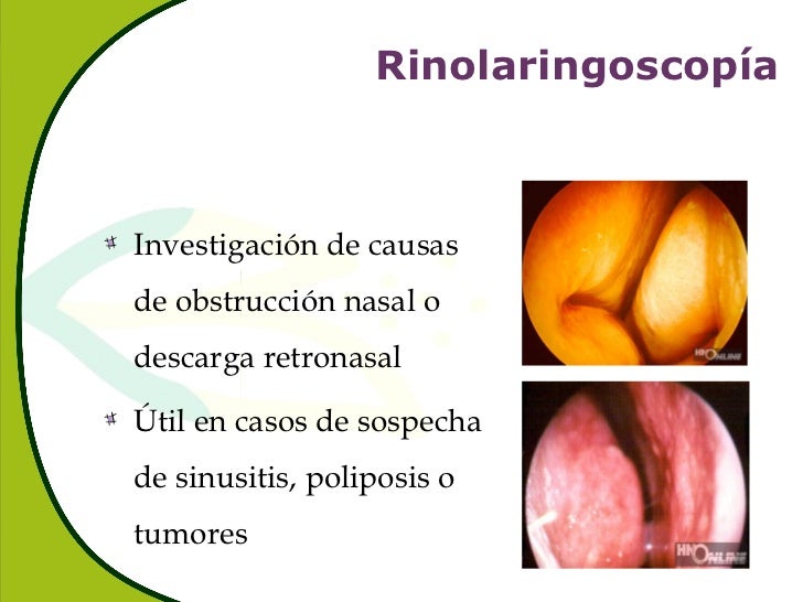 Metodos diagnosticos pregrado