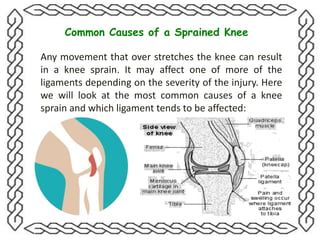 Metro Physio - What is a Knee Sprain? | PPTX