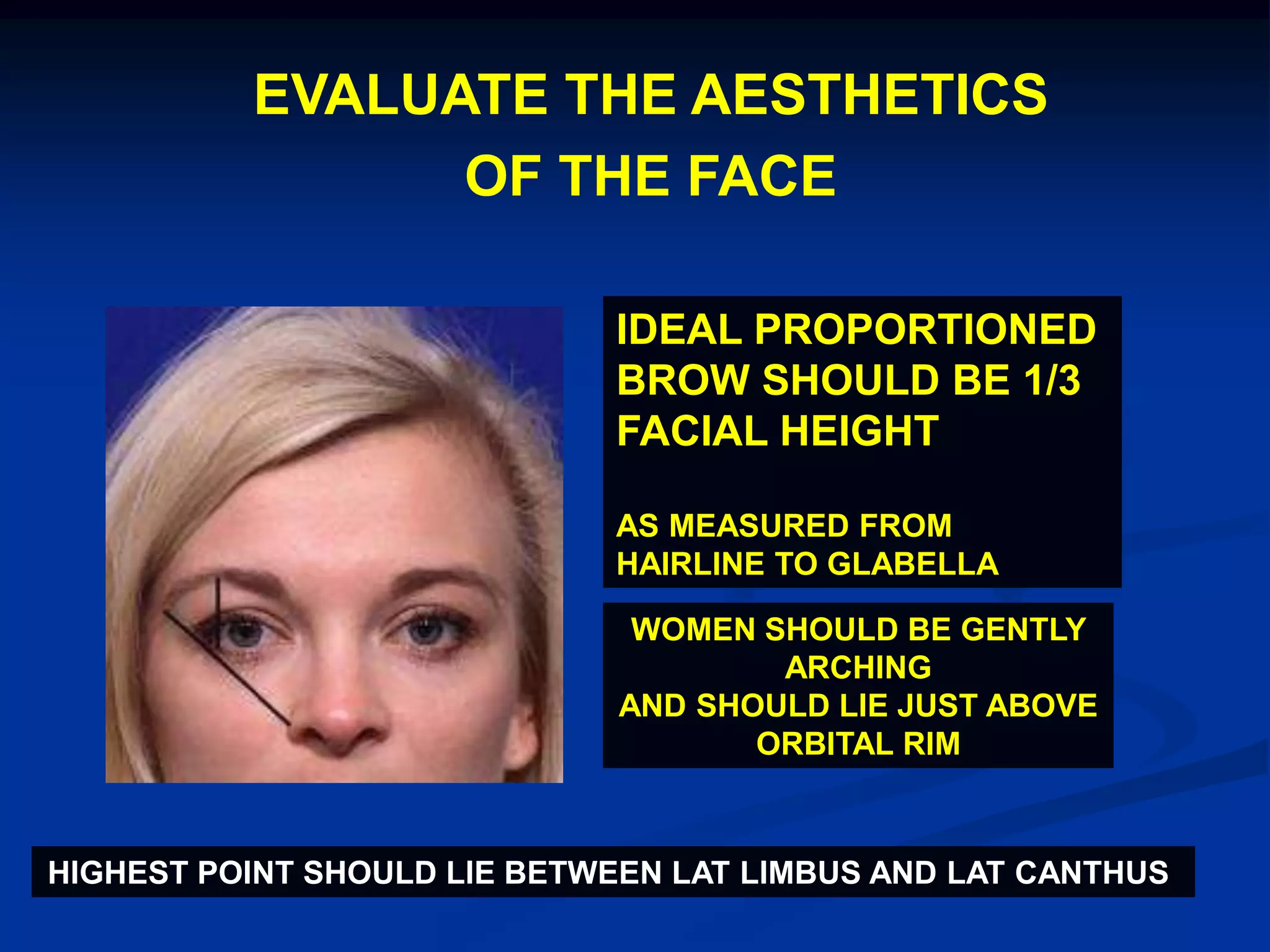 Using Botox for Periorbital Rejuvenation